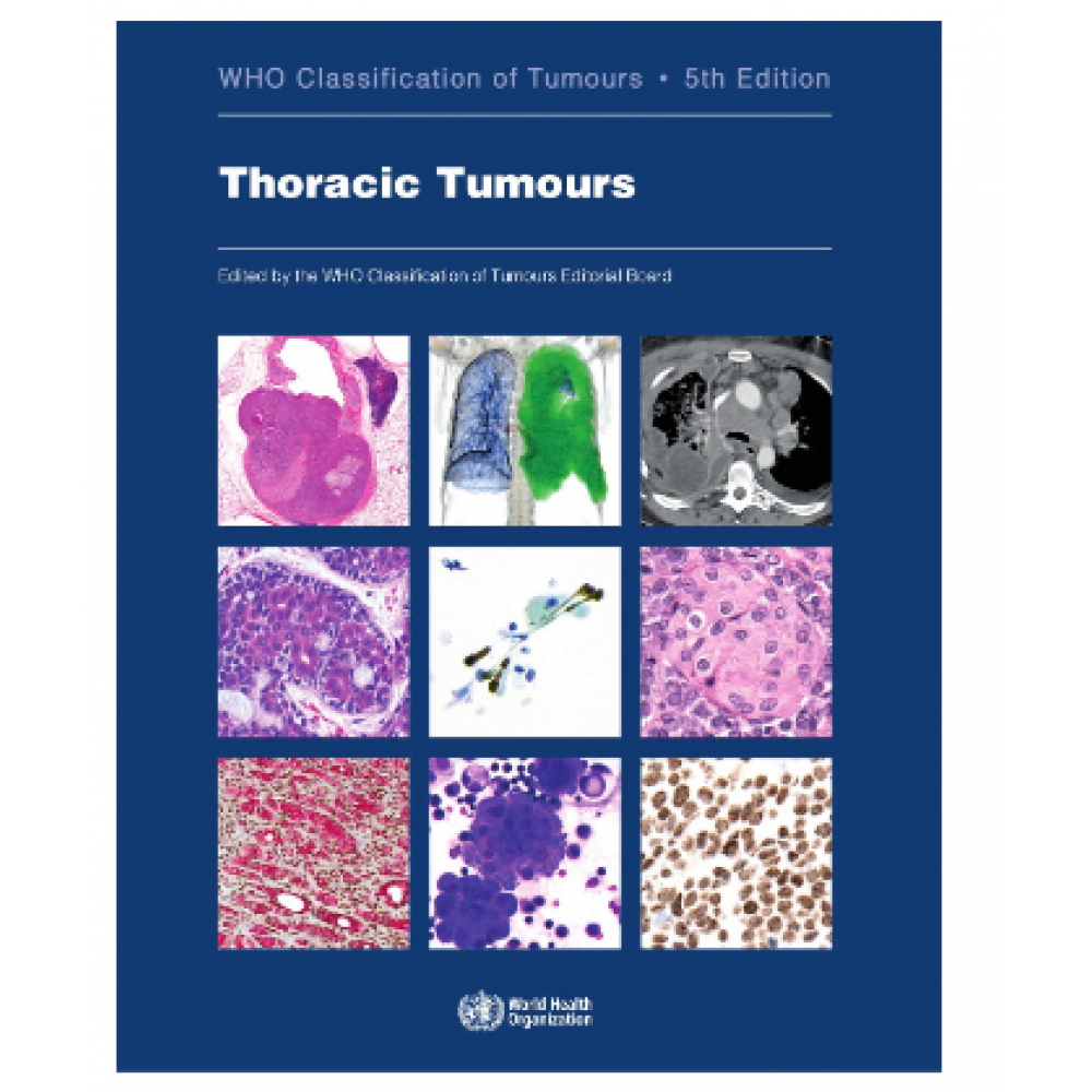 Who S Classification Of Tumours Thoracic Tumours Volume 5 5th Edition
